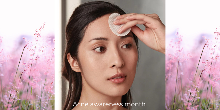 Beautology Shop | 5 Ways to Celebrate Acne Awareness Month – Beautology ...